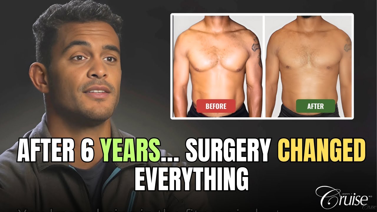 Testimonial - Gynecomastia Surgery Type 1 - YouTube