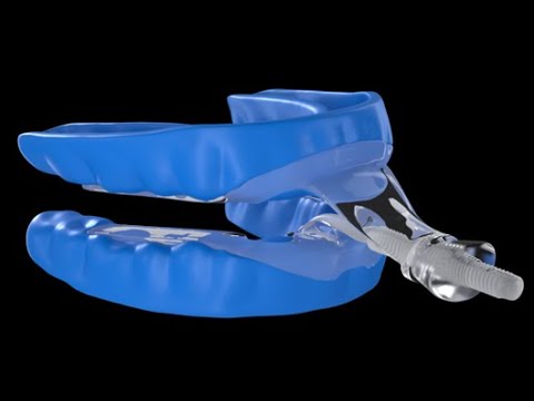 flexTAP Presentation - YouTube