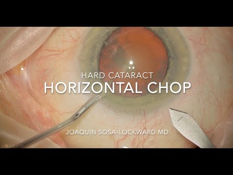 Clip #32 -4K- Horizontal Chop and Mechanical Fracture - YouTube