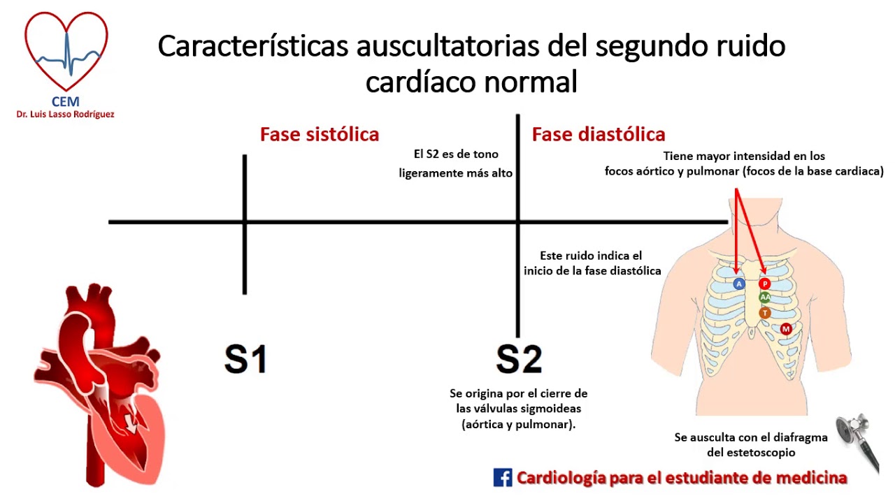 Auscultación del segundo ruido cardíaco normal - YouTube