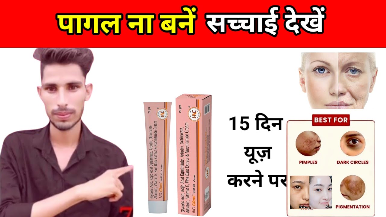 ng glow cream review in hindi,gora hone wala cream,ng glow cream,uses ...