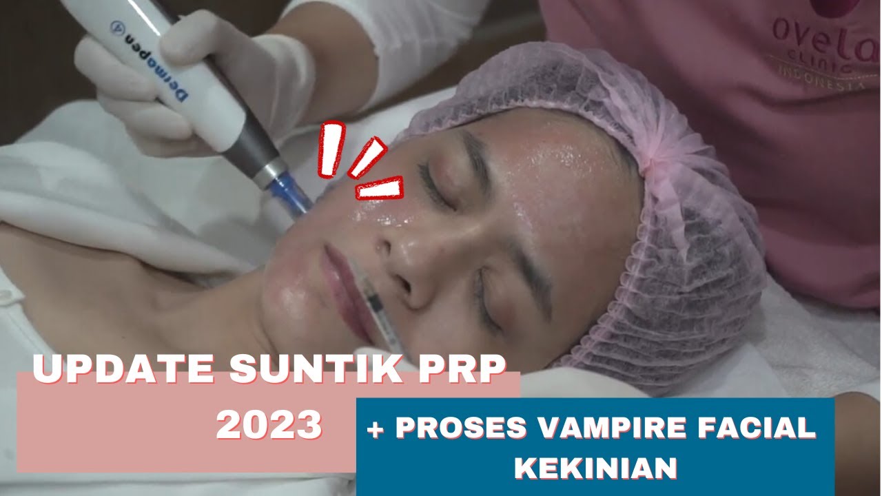 PRP Treatment Indonesia Before and After (+ Latest Generation of ...