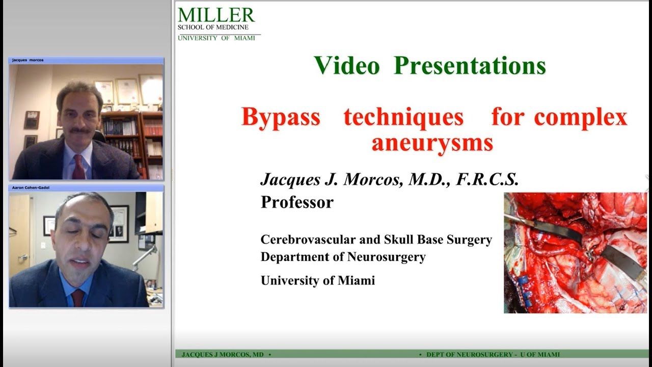 Bypass Techniques for Complex Intracranial Aneurysms by Jacques J ...