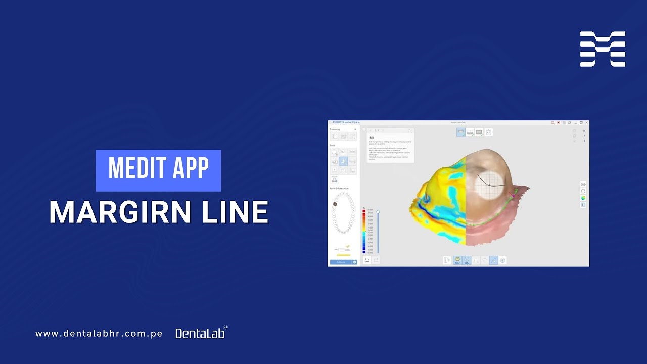 Medit App Margin line - YouTube