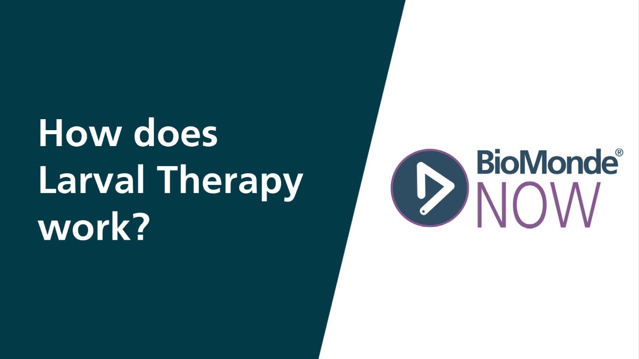 How does Larval Therapy work? | Your Questions Answered - YouTube