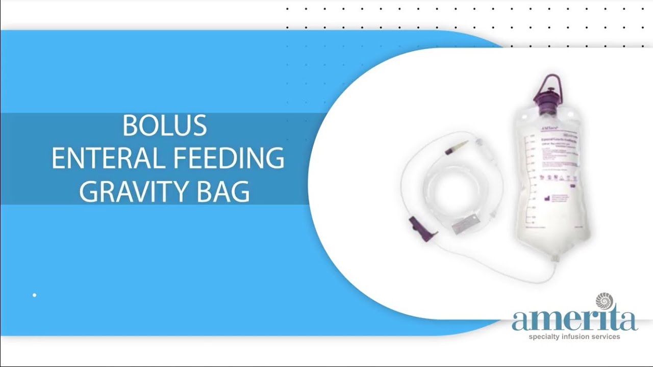 Bolus Enteral Feeding Via Gravity Bag - YouTube