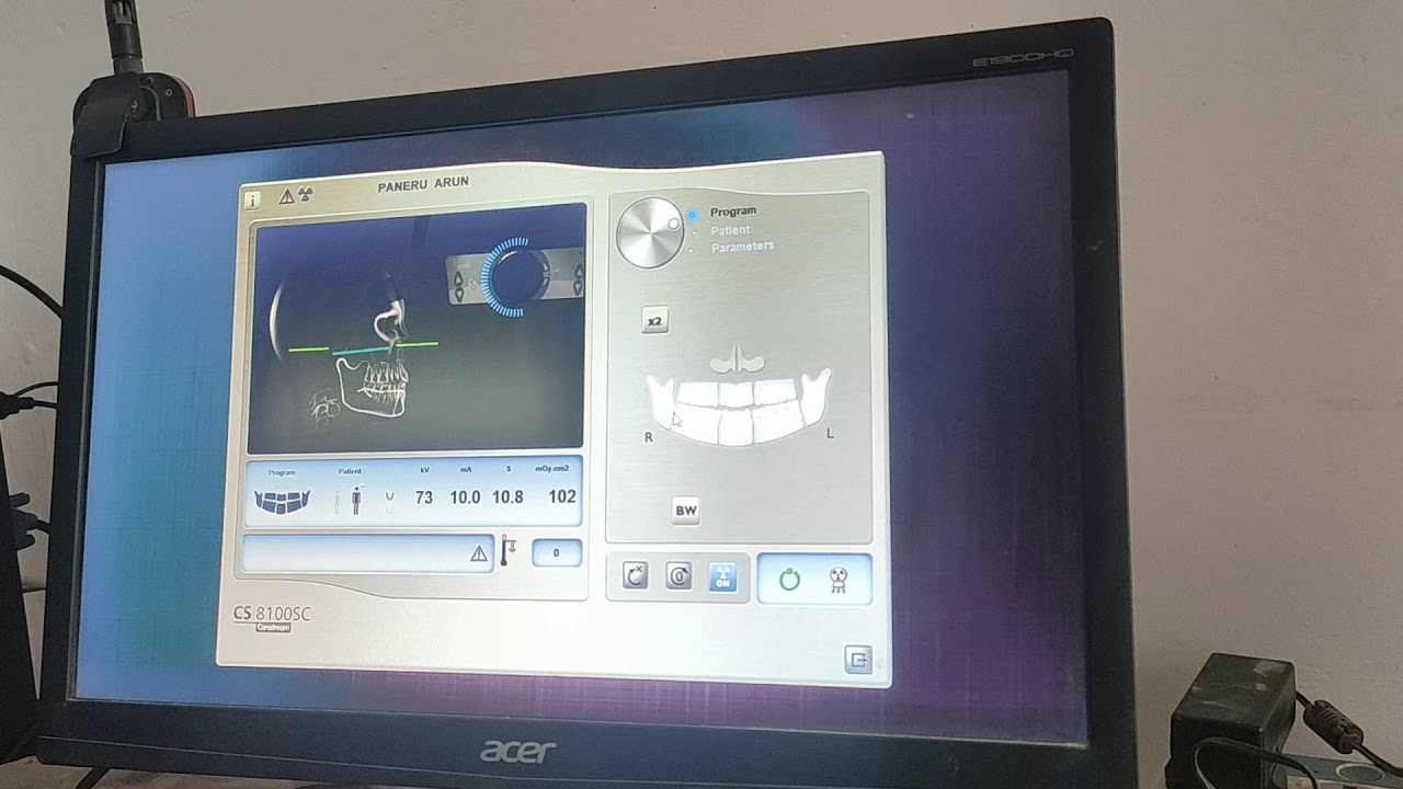 OPG / Carestream / Operational Training Tutorial / How to setup printer ...