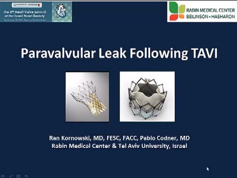 The Significance and How to Minimize Aortic Regurgitation after TAVI ...