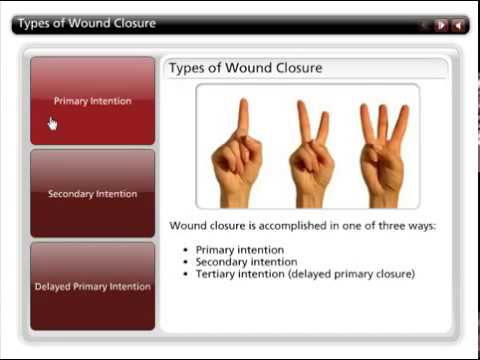Types of Wound Closure - YouTube