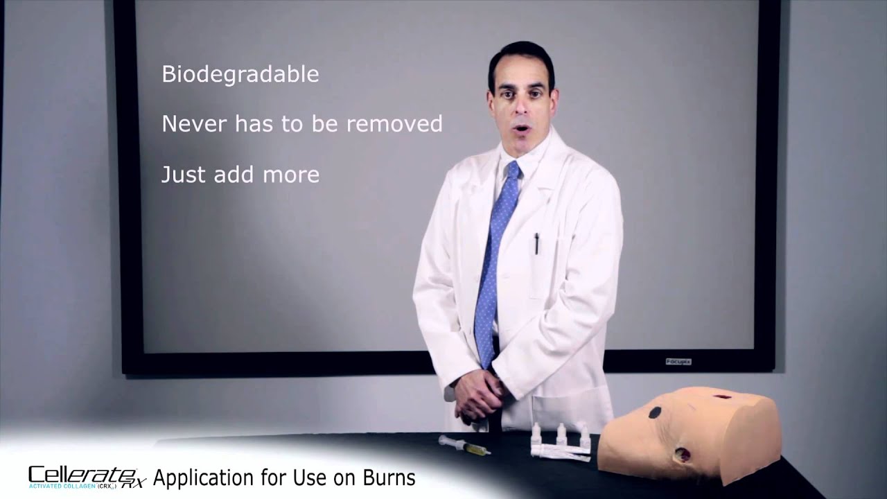 CellerateRX Activated Collagen Use on Burns - YouTube