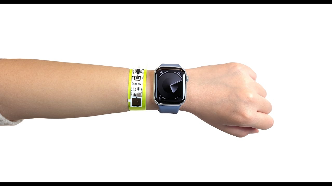 WatchLink: Enhancing Smartwatches with Sensor Add-Ons via ECG Interface ...