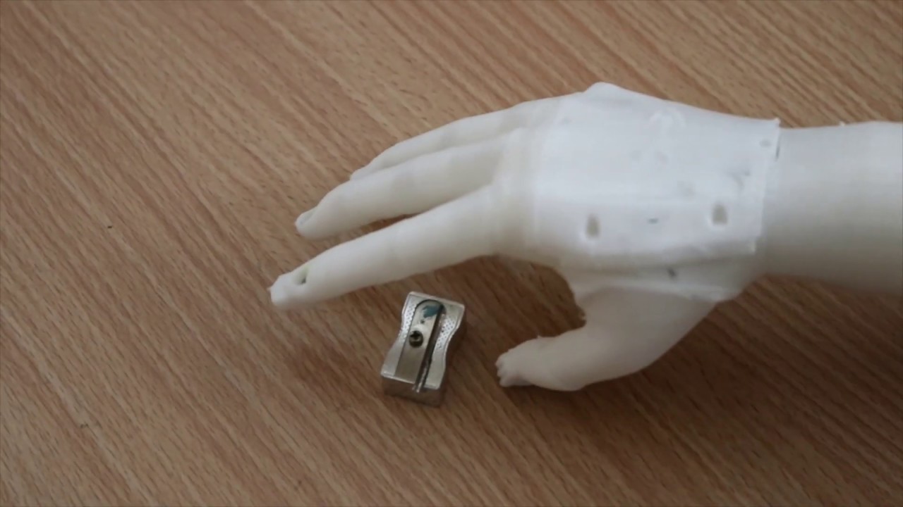 X-Limb mini: A Paediatric 3D-Printed Soft Robotic Hand Prosthesis for ...