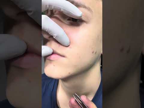 s.kincare satisfying videos by Nedim Kaya 