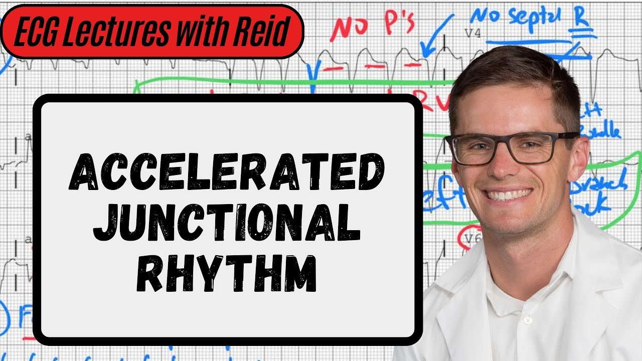 Accelerated Junctional Rhythm | Day 19 ECG Challenge - YouTube