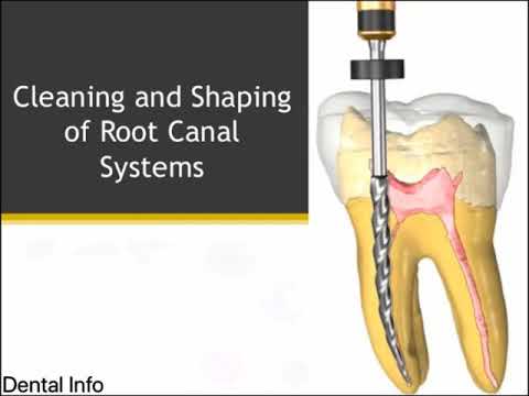 Cleaning And Shaping Of Root Canal Systems | Lecture - YouTube