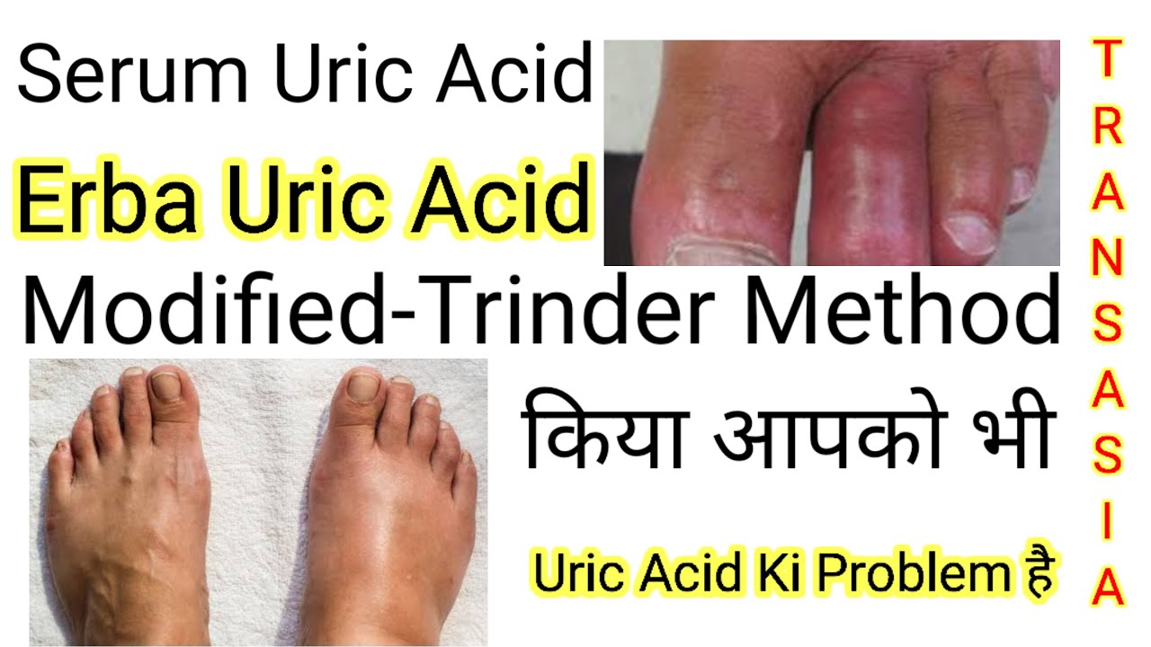 uric acid test | uric acid test erba reagent | Trinder method - YouTube