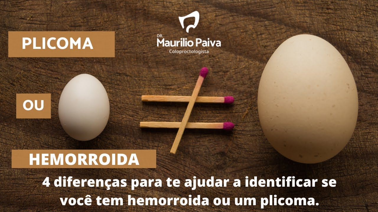 Plicoma ou hemorroida? 4 diferenças para te ajudar a identificar se ...
