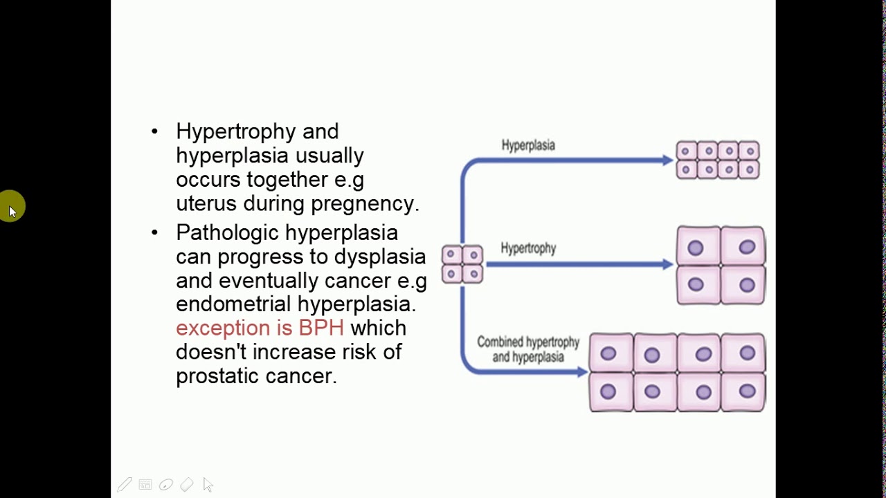 growth adaptations. hypertrophy and hyperplasia. - YouTube