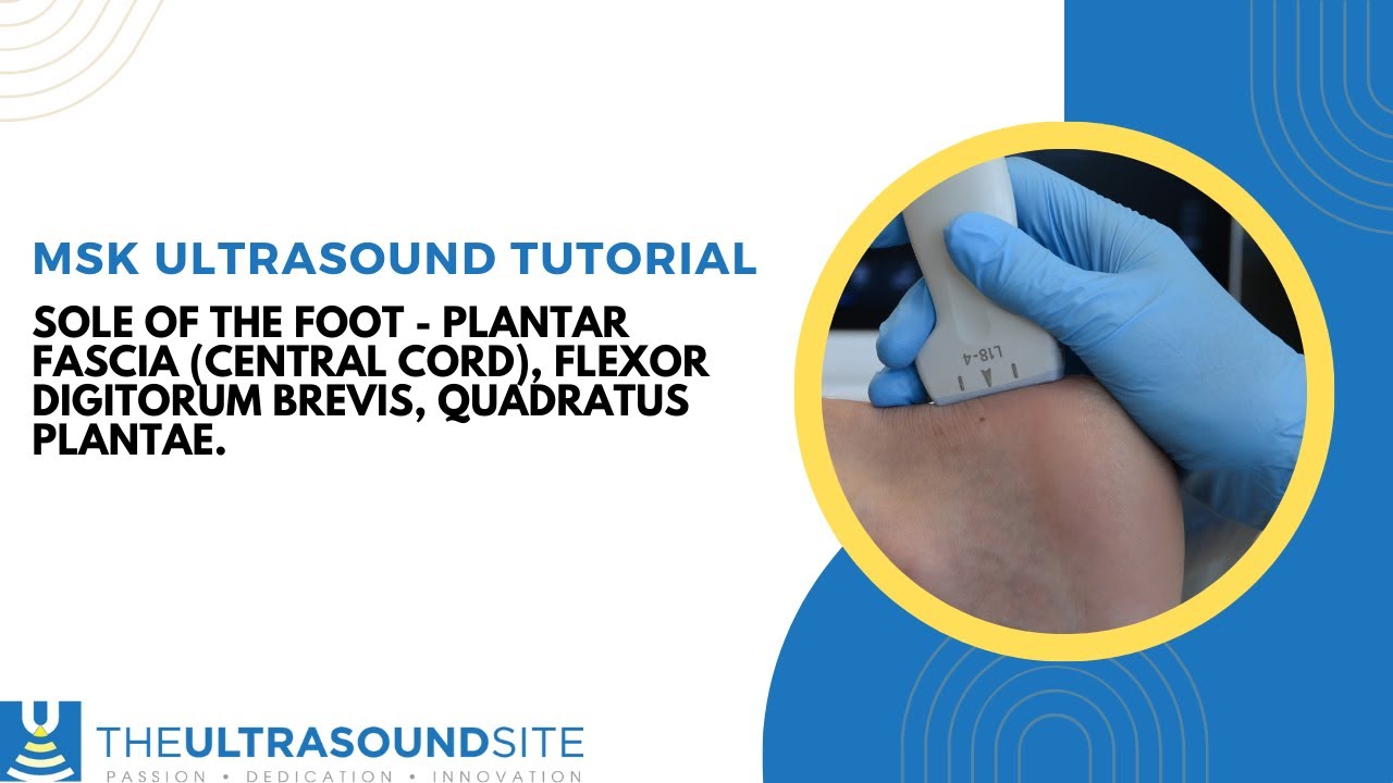 MSK ultrasound of the plantar foot - YouTube