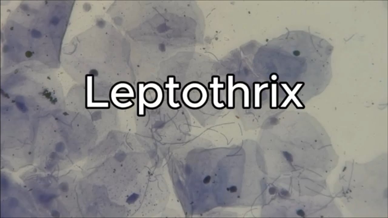 Leptothrix - YouTube