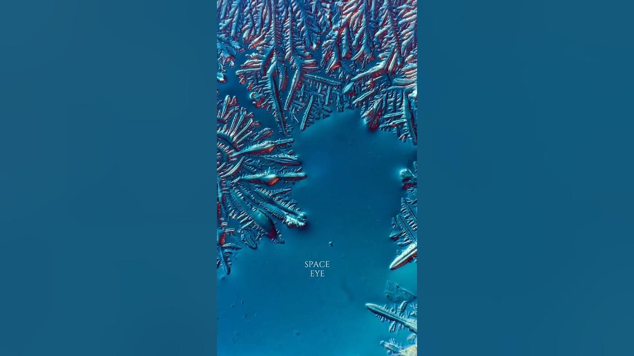 Tears under microscope | Science | Knowledge - YouTube