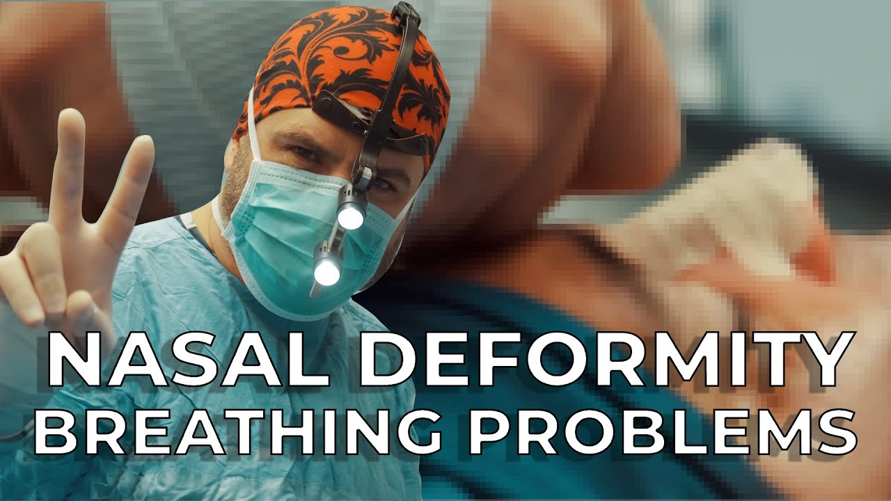 Nasal Deformity & Breathing Problem was over! #Rhinoplasty - YouTube