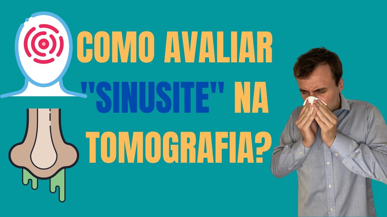 Como avaliar sinusite na tomografia - YouTube
