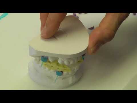 Silensor®-sl Registrierung - YouTube