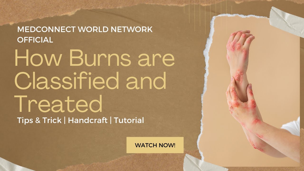 How Burns are Classified and Treated || #burns #TreatingBurns # ...