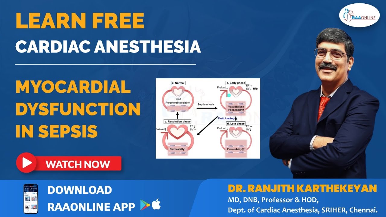 Cardiac Anesthesia | Myocardial Dysfunction in Sepsis | by Prof ...