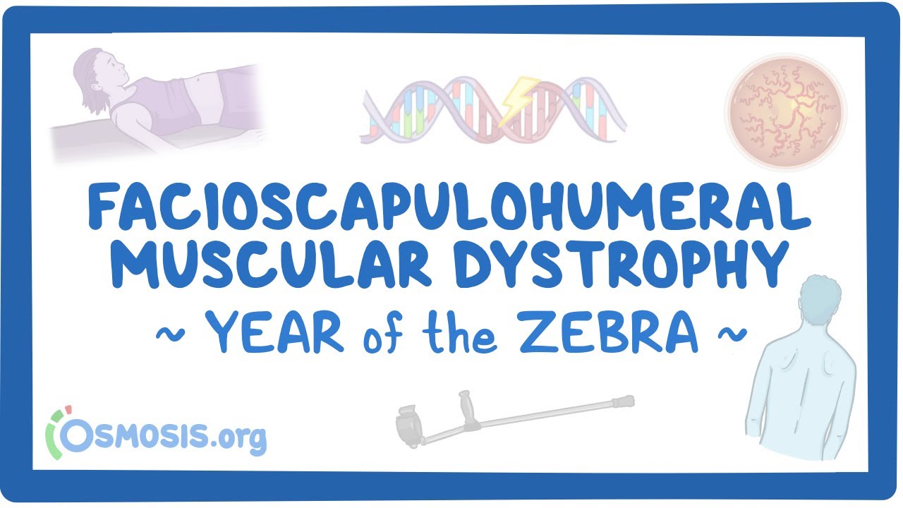 Facioscapulohumeral muscular dystrophy (Year of the Zebra) - YouTube