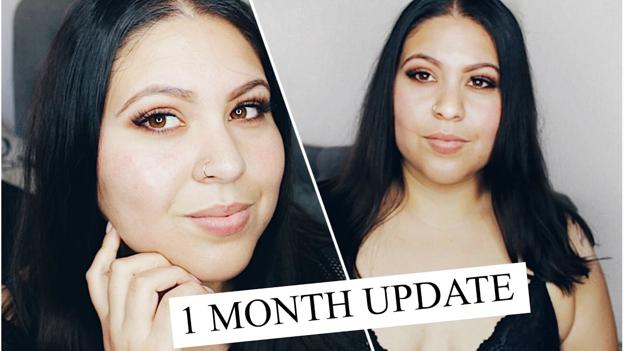 1 MONTH POST OP UPDATE| VSG - YouTube