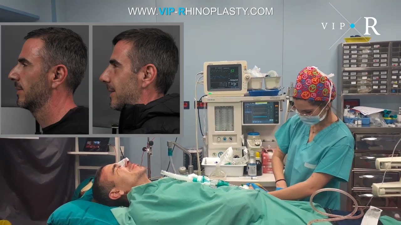 Watch how easy our patient wakes up after surgery💎Εύκολο Ξύπνημα μετά ...
