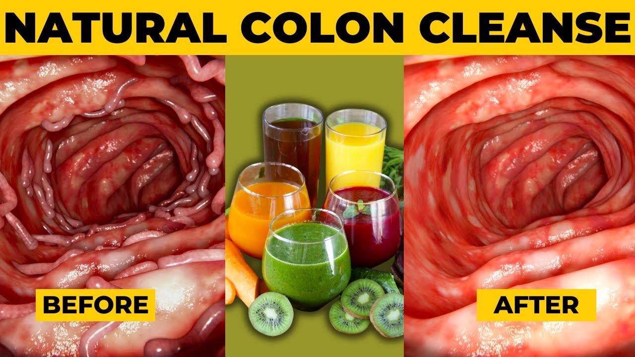 9 Potent Detox Juices To Cleanse The Intestine Natural Colon Cleanse Youtube