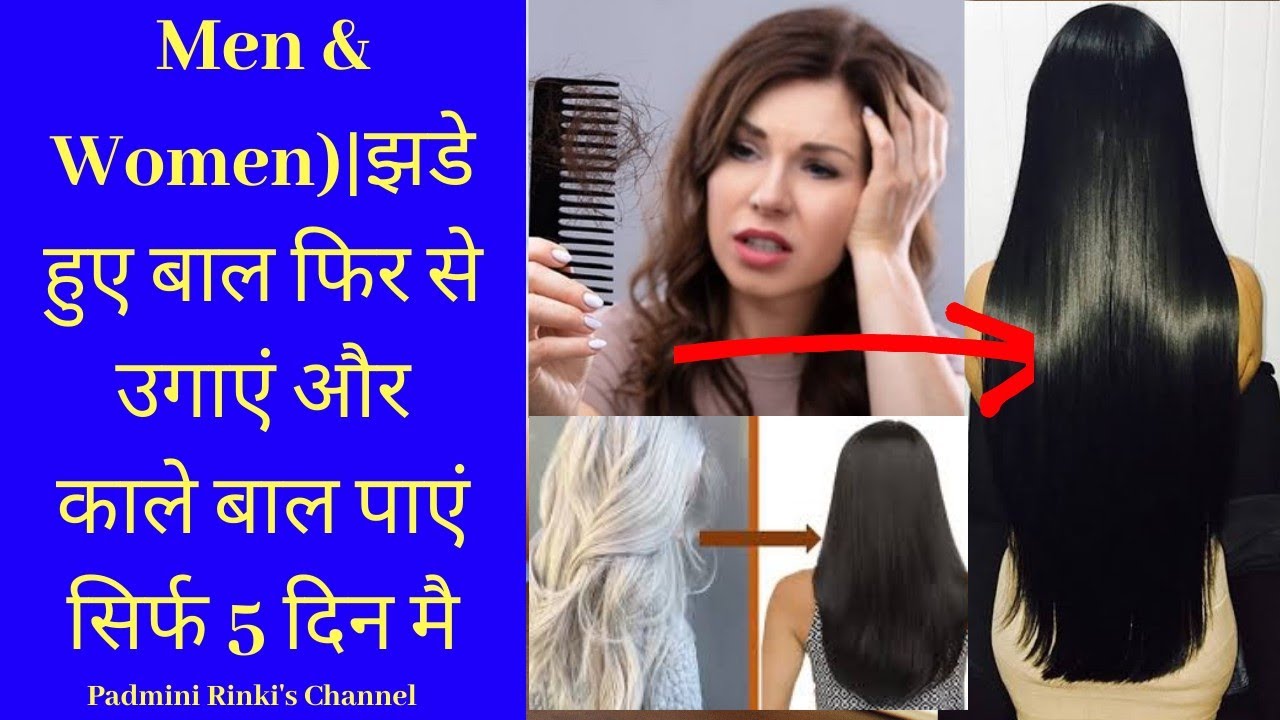 How To Stop Hair Fall And Grow Hair Faster Naturally Men And Women झडे