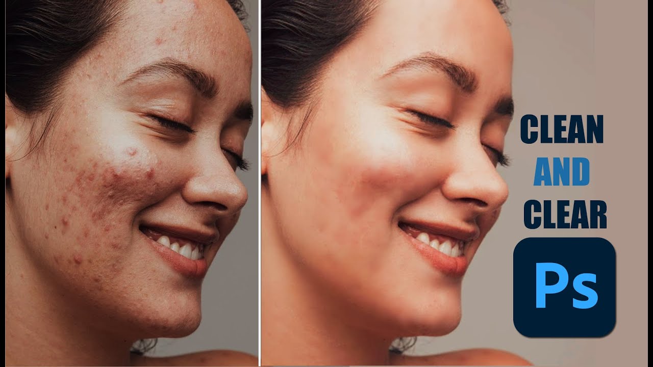 How To Clean Pimple, Acne Face | Retouch | Photoshop | TutorialVideos ...