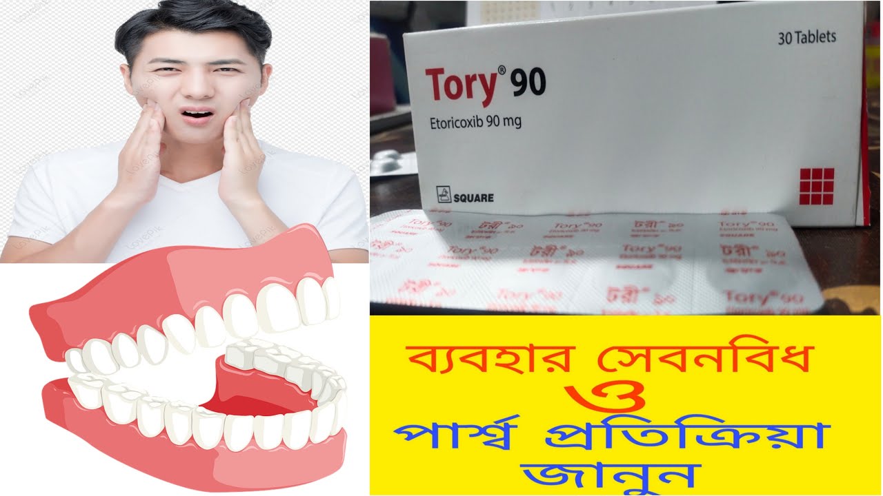 Tory 90 Tablet কিসের ঔষধ.দাত ব্যাথার ঔষধ।Usage And Side Effects.Dental ...