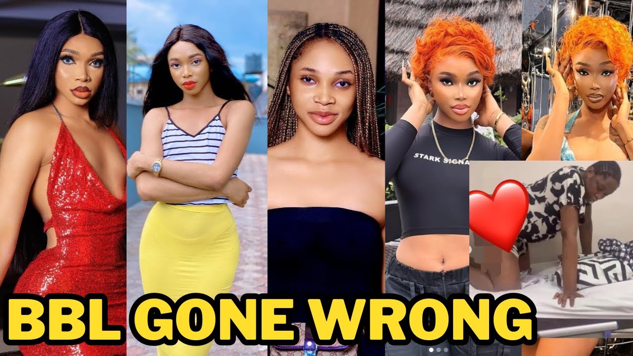 BBL GONE WRONG, 2 FAILED KIDNEY, SEPSIS,KIDNEY TRANSPLANT NIGERIAN TRANSGENDER JAY BOOGIE CRIES ...