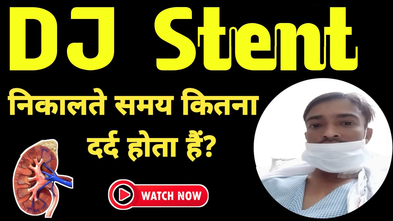 DJ Stent Removal after Kidney Transplant | DJ Stent निकालने में कितना ...
