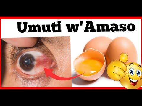 Umuti Wikirundi / Umuti Kama, Ivure Amaso Nawe! - YouTube