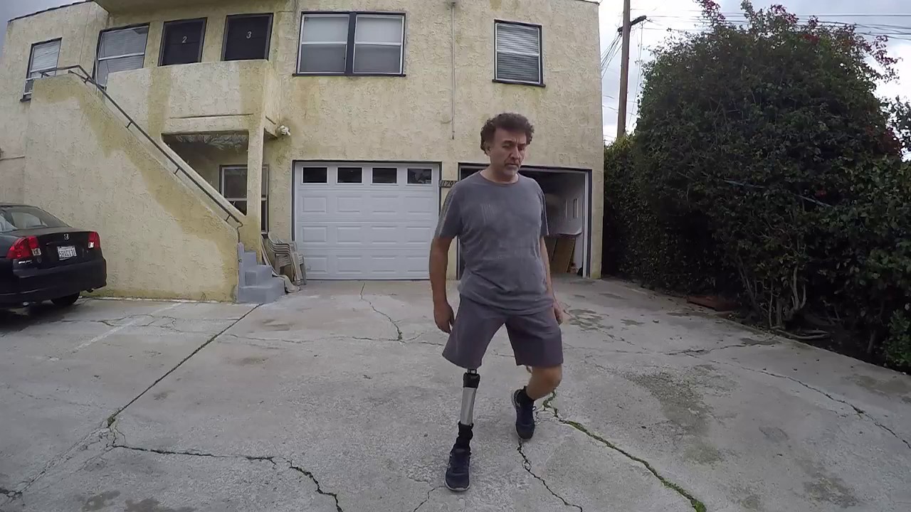 C-Leg knee test very short stump ( 2 inches long!!) above knee amputee ...