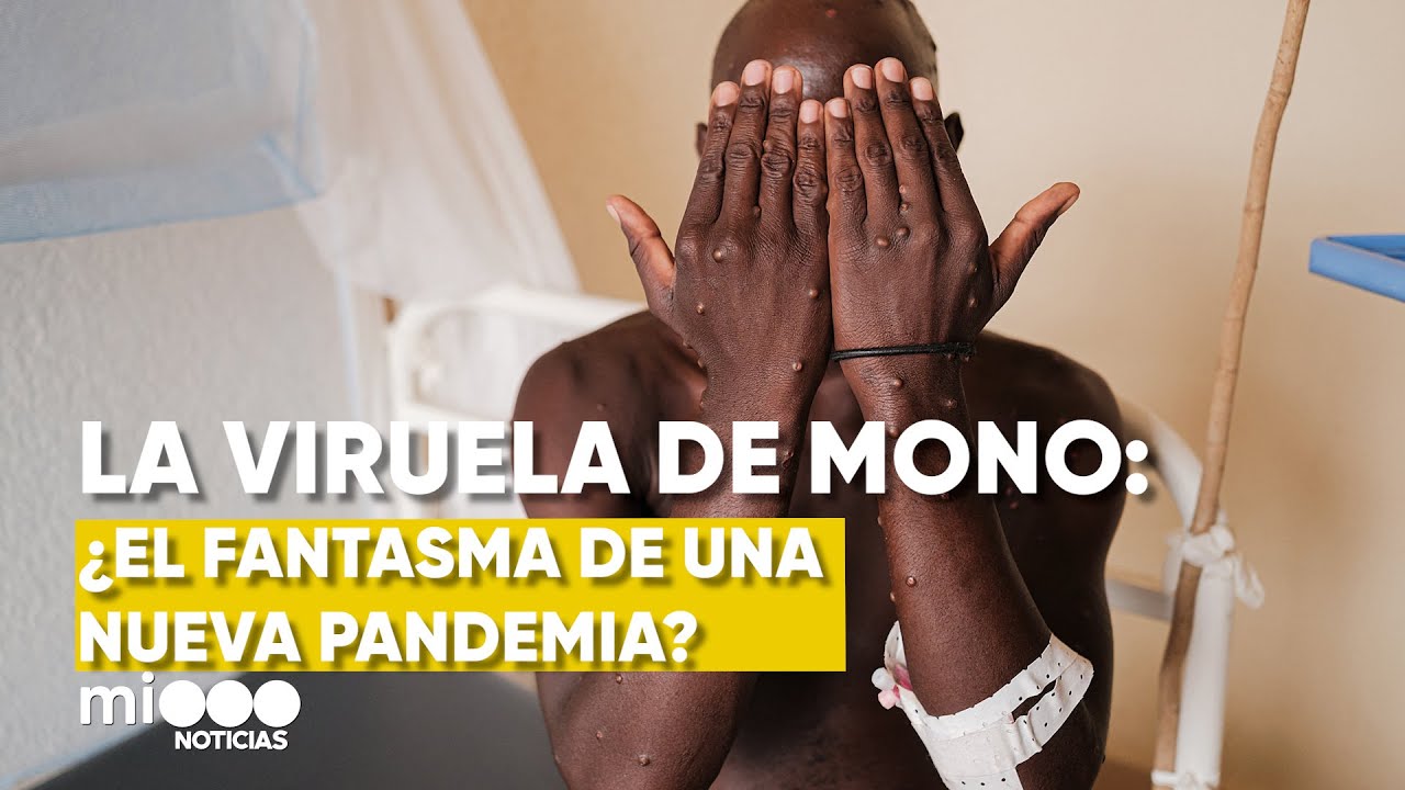 VIRUELA de MONO: ¿el FANTASMA de una nueva PANDEMIA? - #TFN - YouTube