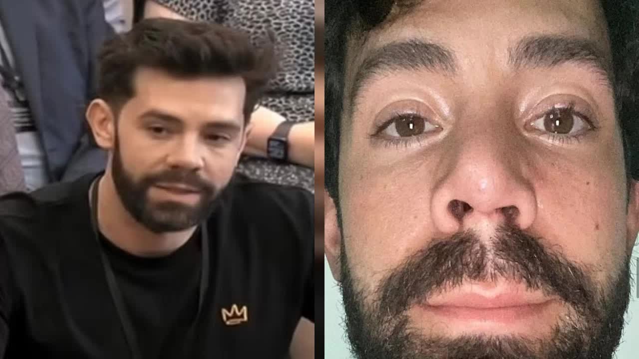 TOWIE hunk Charlie King was in 'depths of despair' after nose job went ...