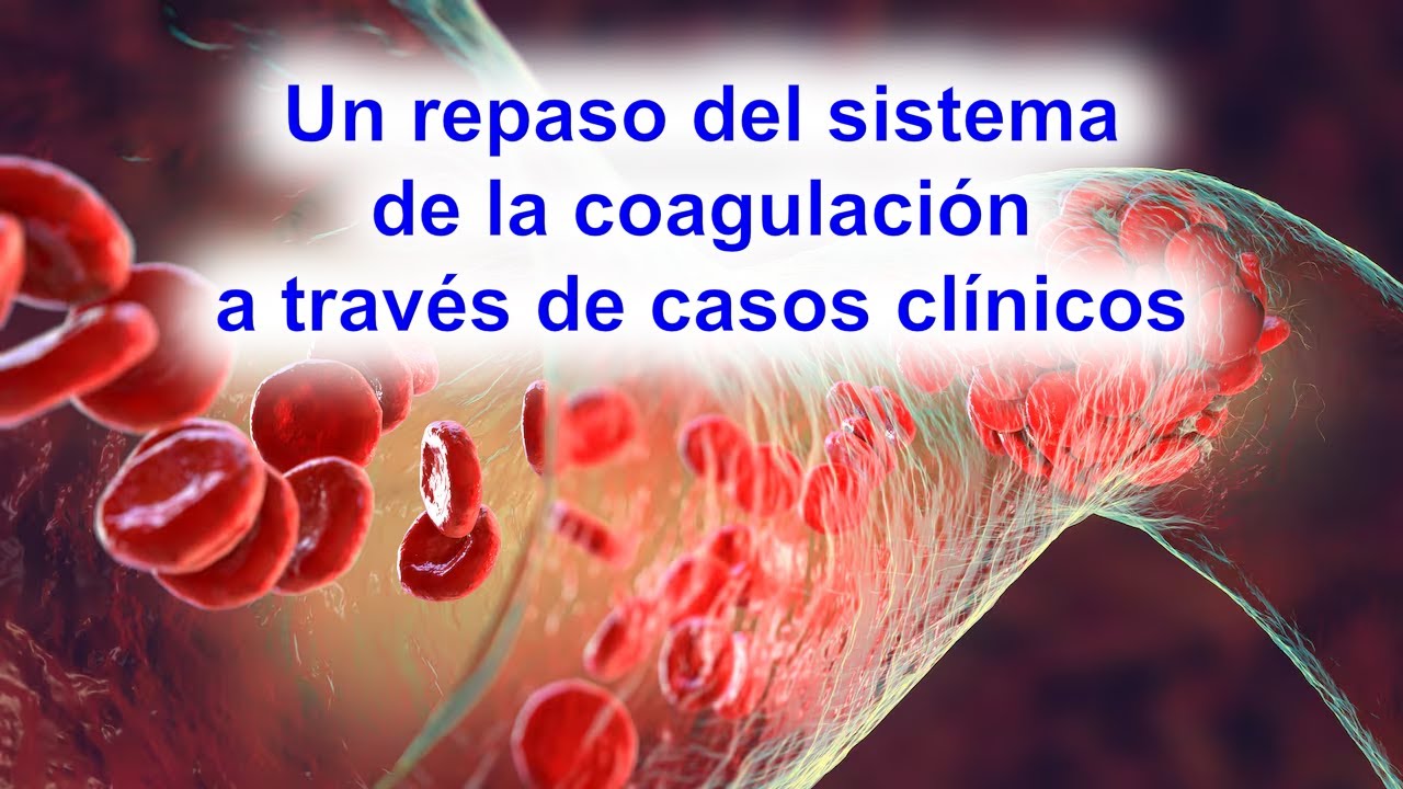 El sistema de la coagulación: un repaso a través de casos clínicos - YouTube