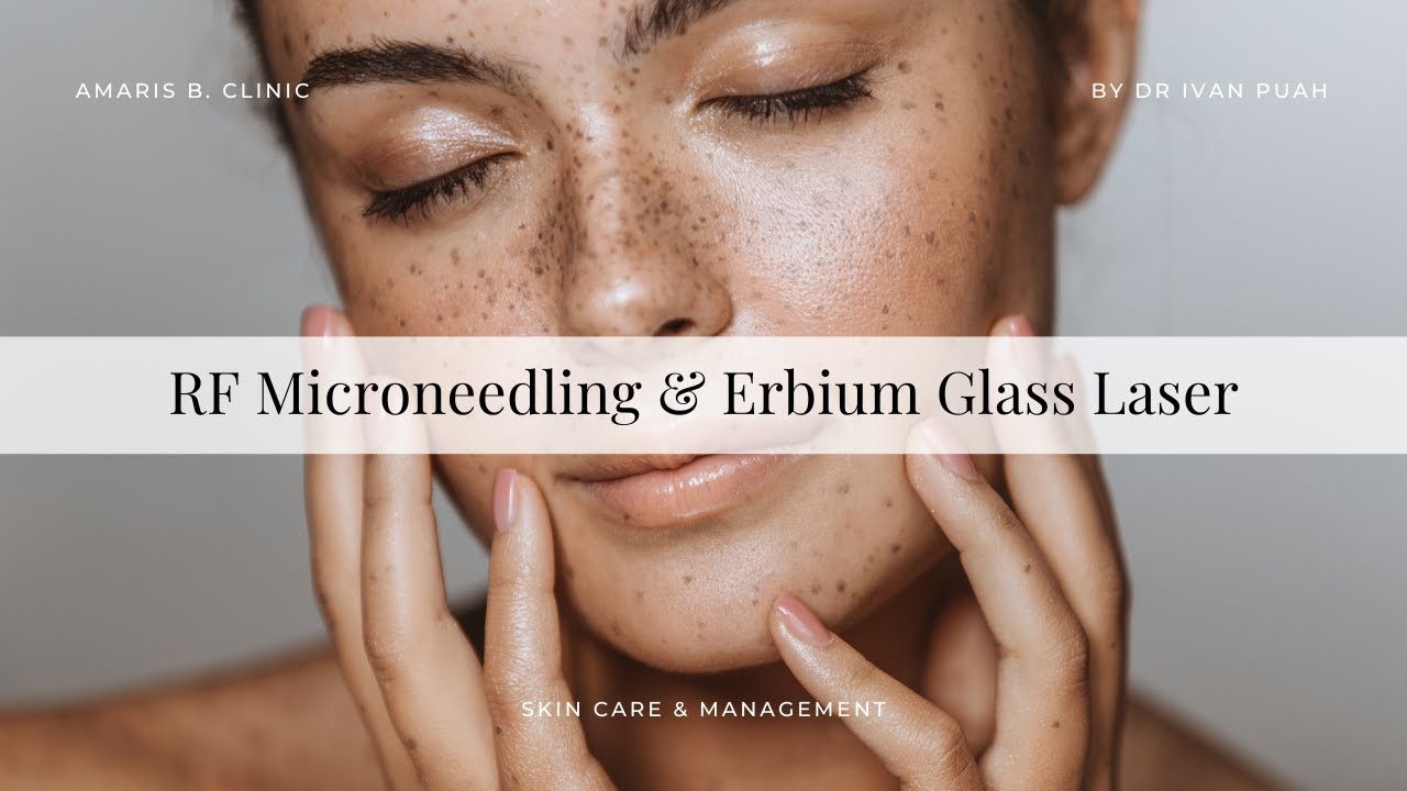 RF Microneedling & Erbium Glass Laser | Benefits, How it works - YouTube
