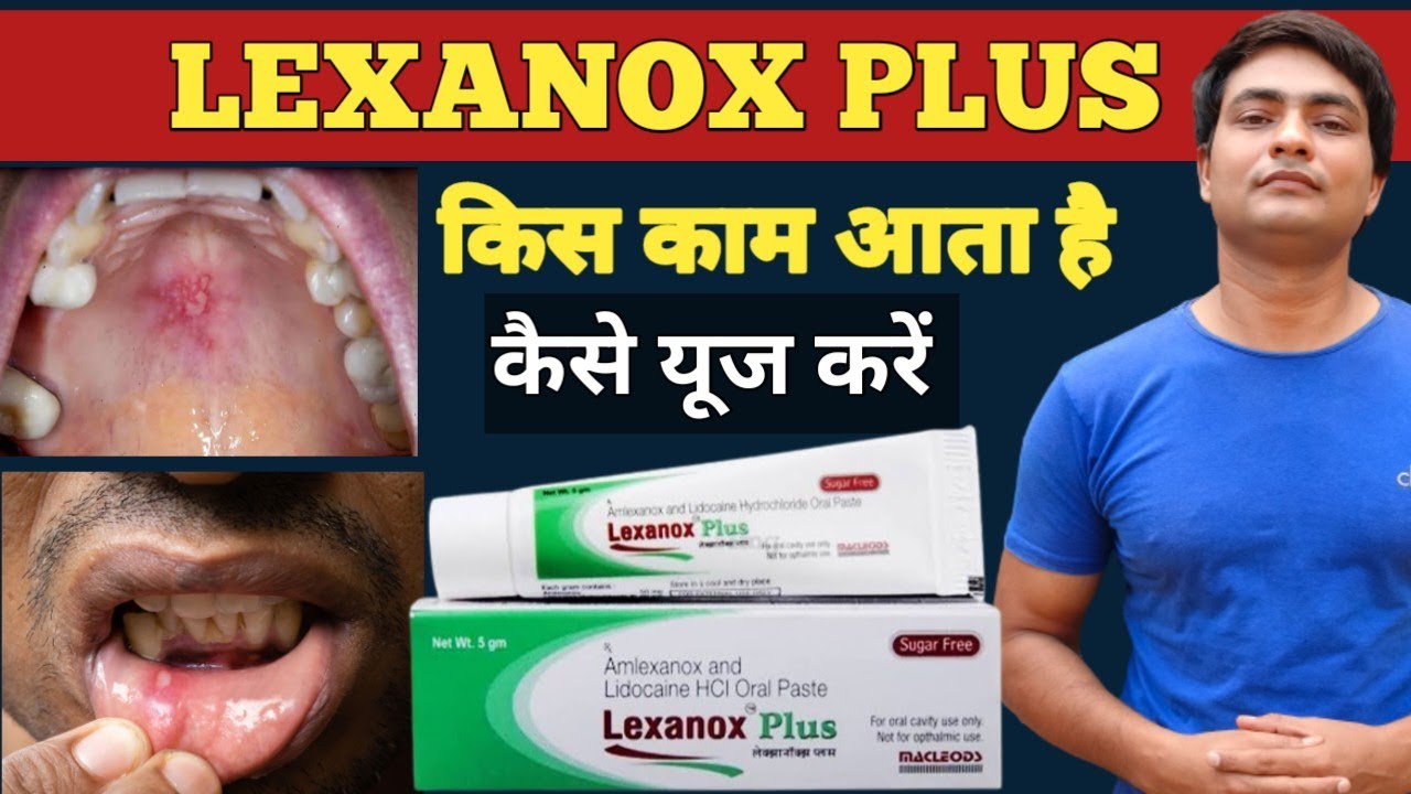 lexanox plus | lexanox plus gel uses in hindi | lexanox plus uses in ...