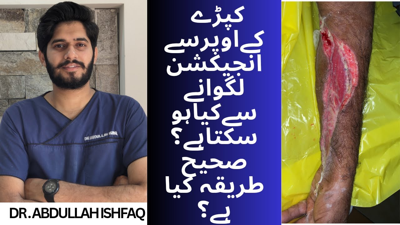 Injection site abscess | causes | signs and symptoms | treatment ...