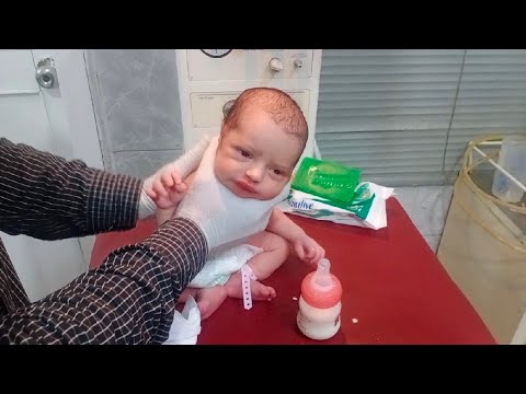 New born baby came with the complain of reluctant to feed but when i ...