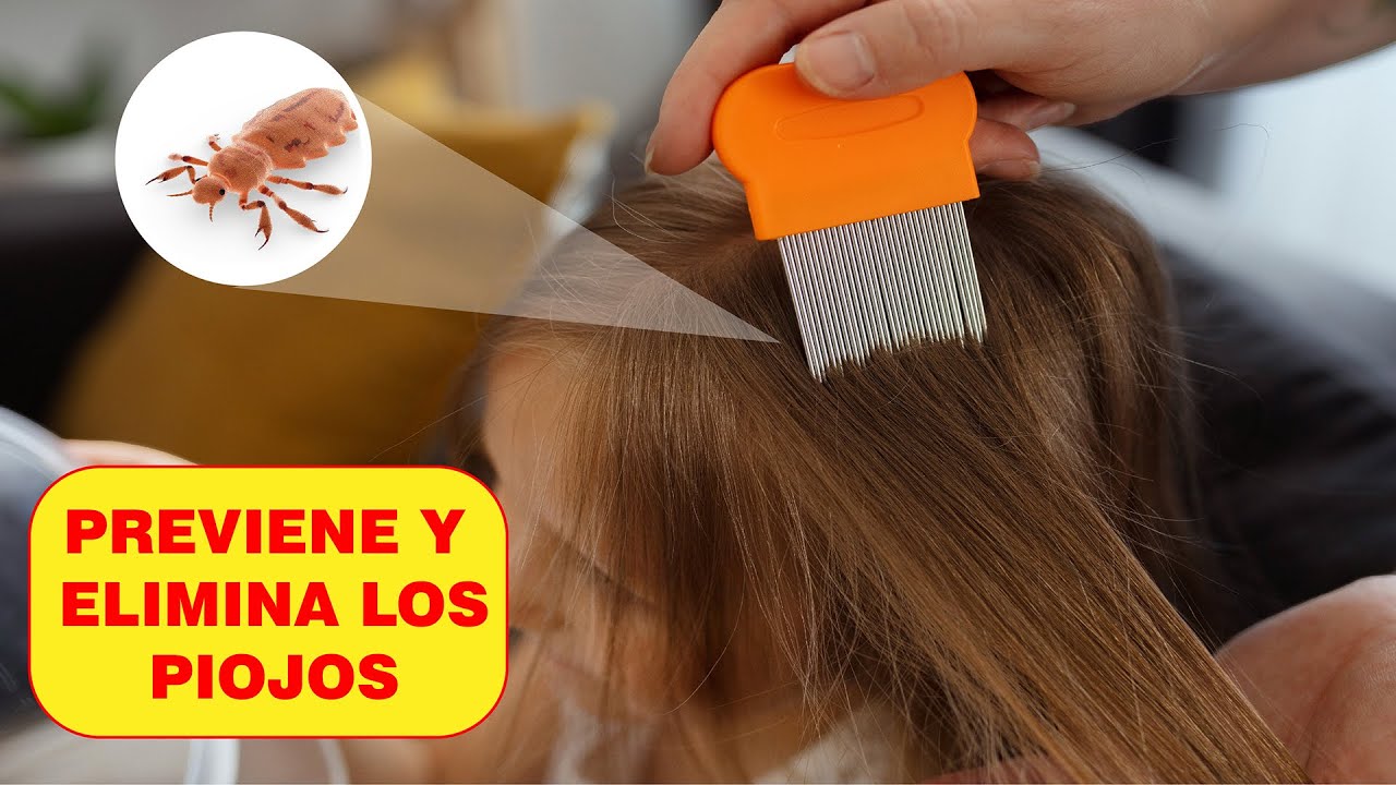 5 REMEDIOS para mantener a raya los PIOJOS y LIENDRES - YouTube