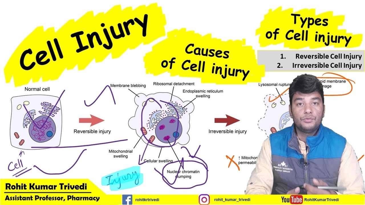 Cell injury pathology | types | etiology | pathophysiology - YouTube